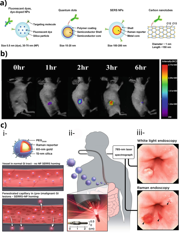 Hybrid Theranostics Nanomaterials | Springer Nature Link