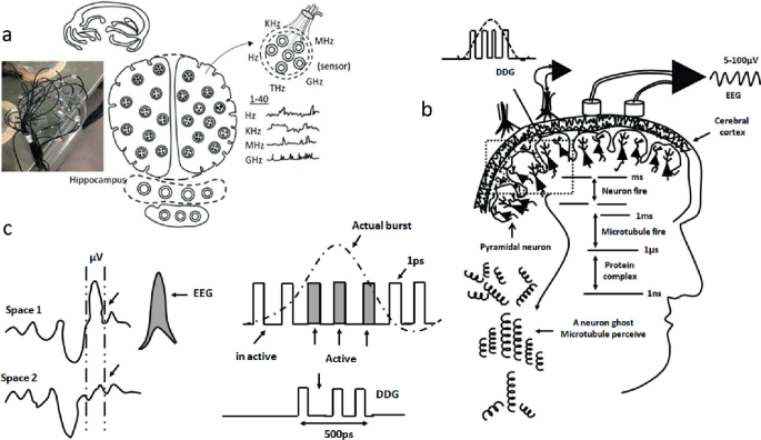 Inventing the Potential of a High-Frequency EEG, Namely Dodecanogram ...