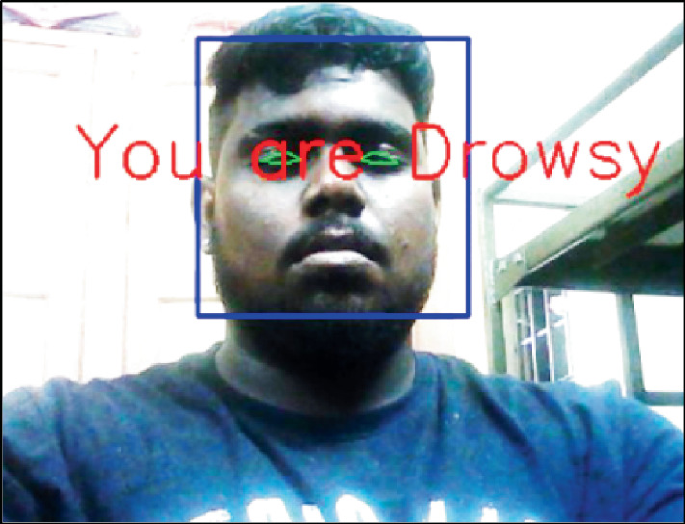 Drowsiness Detection Using Adaboost Method and Haar Cascade Classifier ...