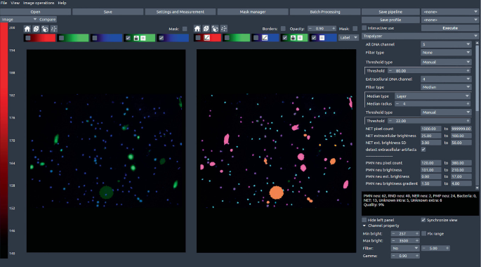 PartSeg v2: Bioimage Segmentation Using Advanced Deep Learning ...