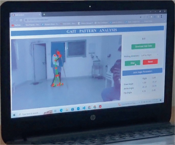 Kinematic Gait Analysis Using Markerless System to Determine Joint ...