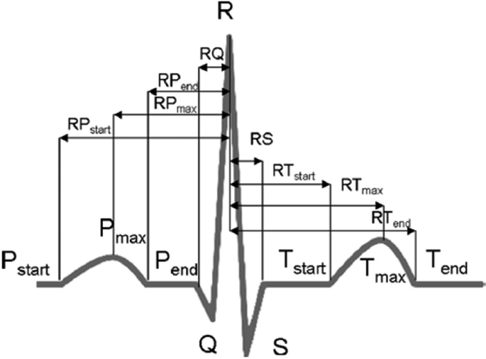 Heart Arrhythmia Detection Through Real-Time ECG Acquisition by Machine ...
