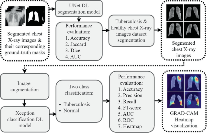 Integrating Artificial Intelligence for Enhanced Tuberculosis Diagnosis ...