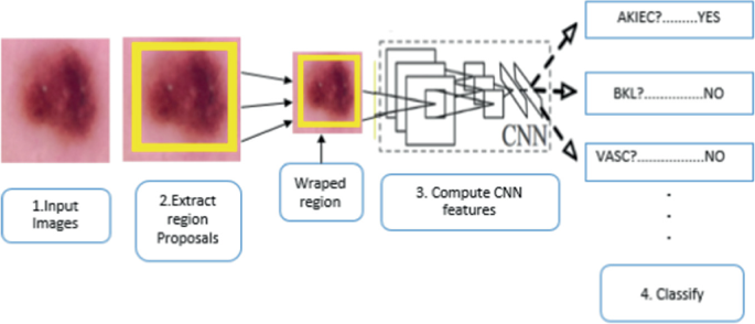 Exploring the Effectiveness of Region-Based CNNs in Skin Cancer ...