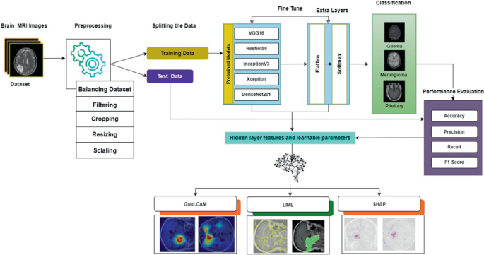 MRI Image-Based Brain Tumor Classification Using Transfer Learning and ...