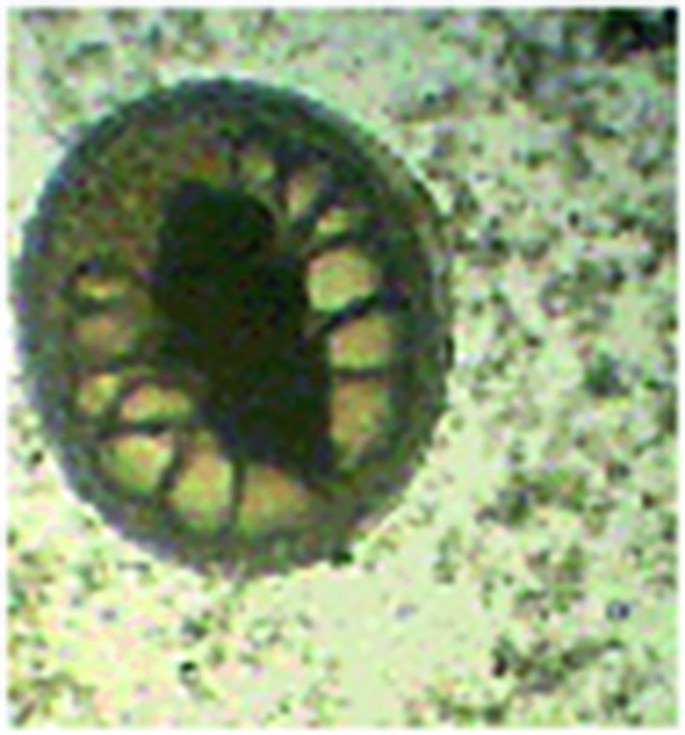 Paragonimiasis | SpringerLink