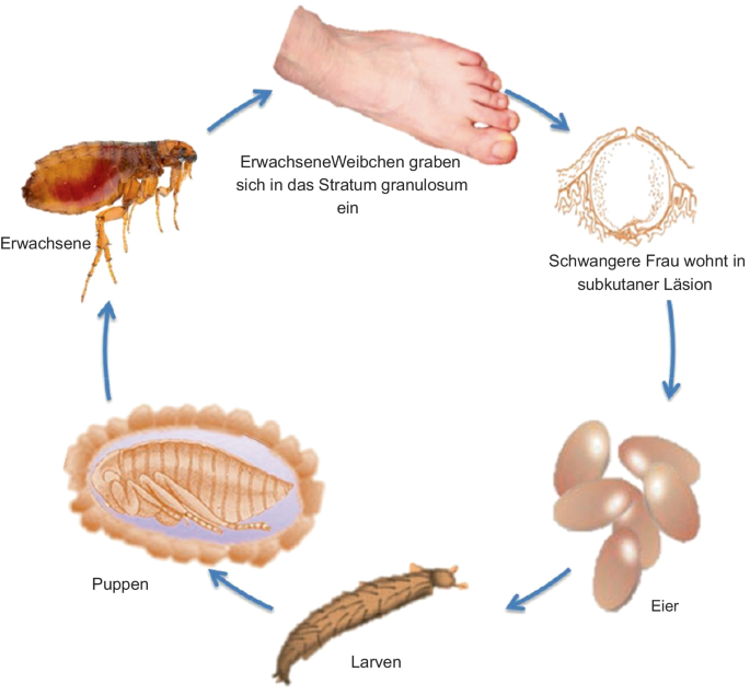 Tungiasis | SpringerLink