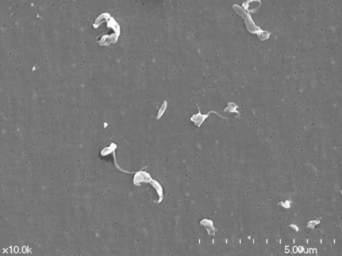 Clinical Studies on Polyethylene Wear | Springer Nature Link (formerly ...