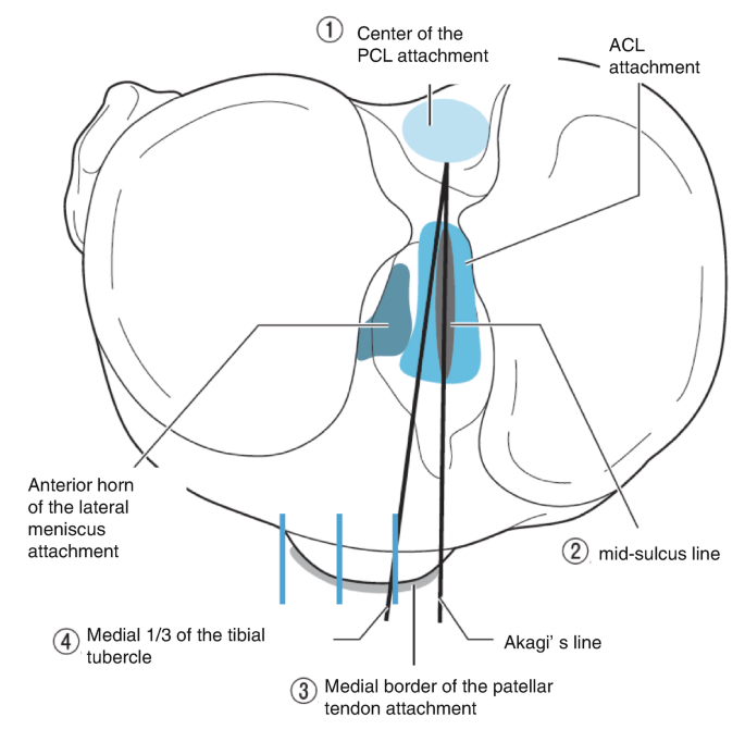 Rotational Alignment | SpringerLink