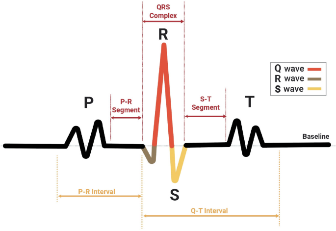 Multifaceted ECG Feature Extraction for AFIB Detection: Using Traditional Machine Learning ...