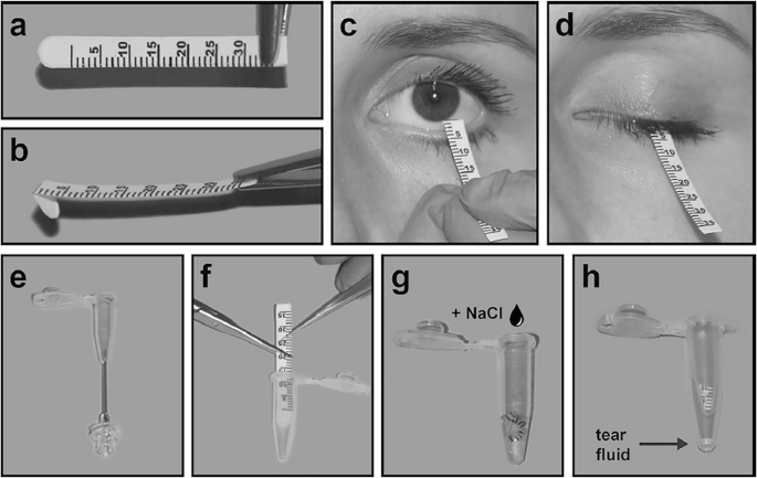 Identification of Tear-Based Protein Biomarkers: Its Application ...