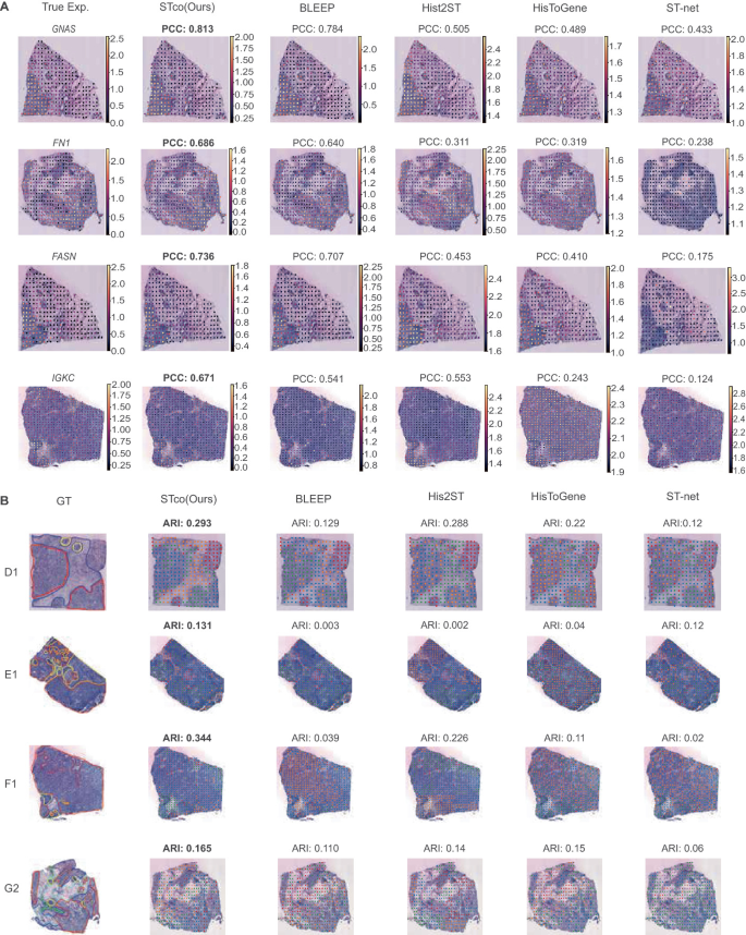 Spatial Gene Expression Prediction from Histology Images with STco | SpringerLink