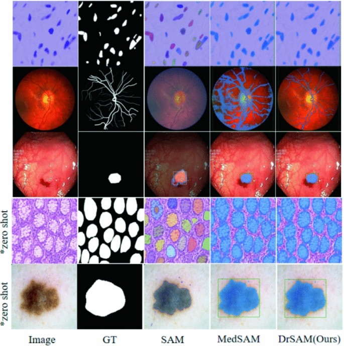 Dr-SAM: U-Shape Structure Segment Anything Model for Generalizable ...