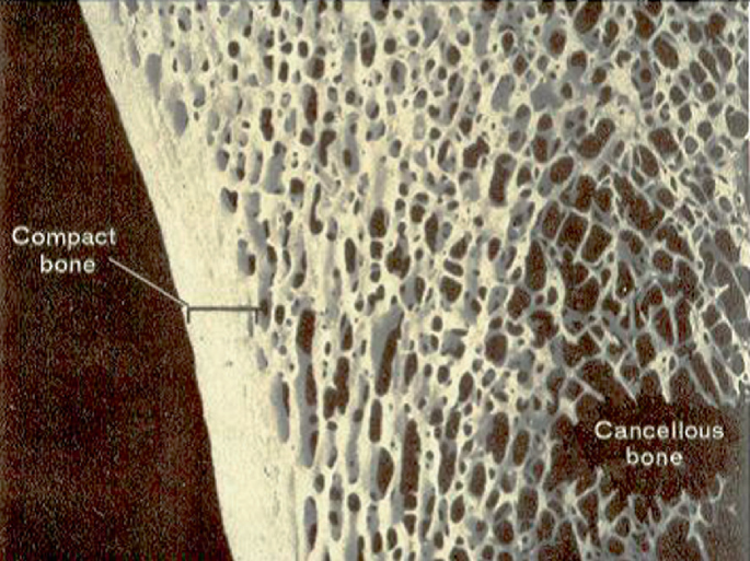 Static Analysis of Artificial Bone Pin Made by Using Nanocomposite ...