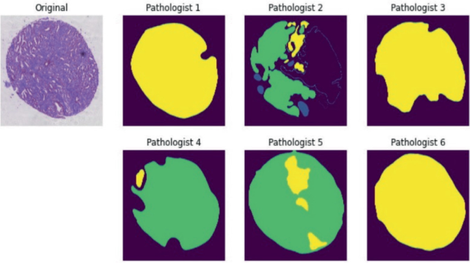 Experiments on Semantic Segmentation of Medical Images with Multilabels ...