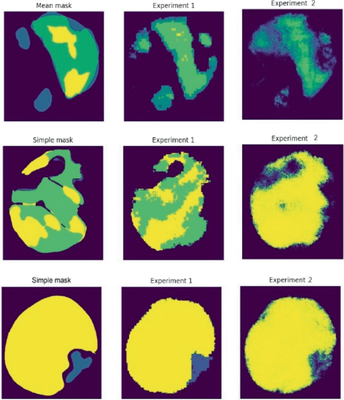 Experiments on Semantic Segmentation of Medical Images with Multilabels ...