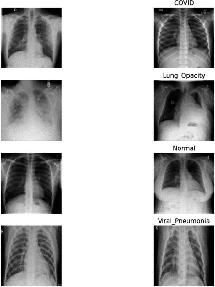Investigating Feature Extraction and Classification Algorithms for Effective Lung Disease ...