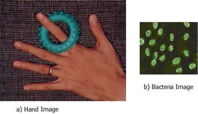 Noisy Digital Image Segmentation Based on Different Similarity Measures Using Clustering ...