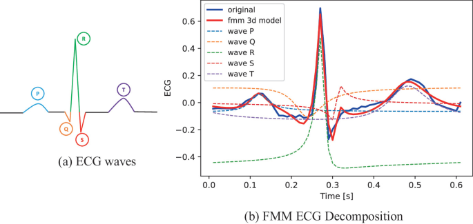 FMM-Head: Enhancing Autoencoder-Based ECG Anomaly Detection with Prior Knowledge | SpringerLink