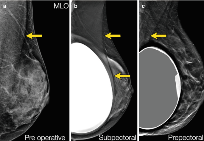 Use of Imaging in Cosmetic Surgery and Medicine | Springer Nature Link