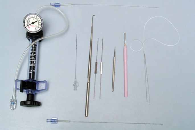 Traditional Balloon Dacryoplasty | SpringerLink