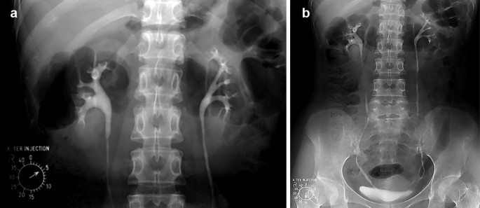 Imaging Techniques of the Urinary Tract | Springer Nature Link ...