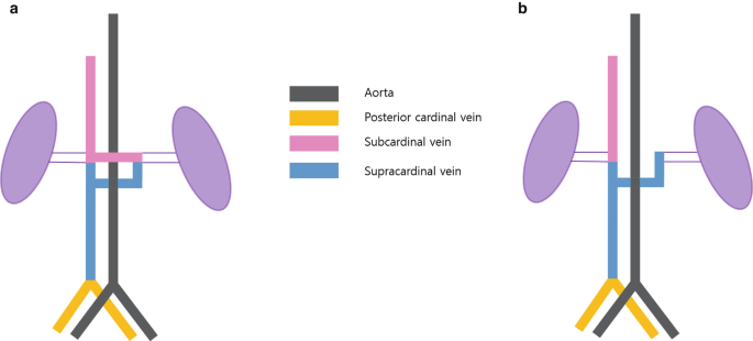 Nutcracker Phenomenon and Syndrome | Springer Nature Link