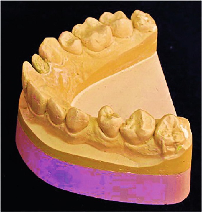 Forensic Odontology | SpringerLink