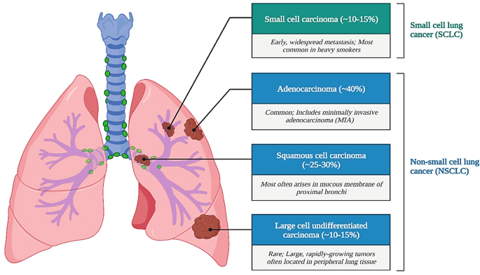 Molecular Insights and Risk Factors Associated with Small and Non-small ...