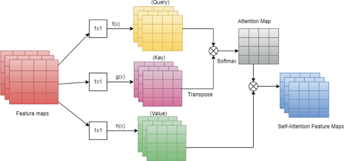 Detection Of Diabetic Retinopathy Severity By Image Classification