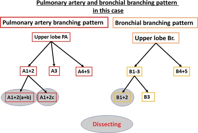 Left S1 + 2 Segmentectomy by Using Electrocautery | SpringerLink