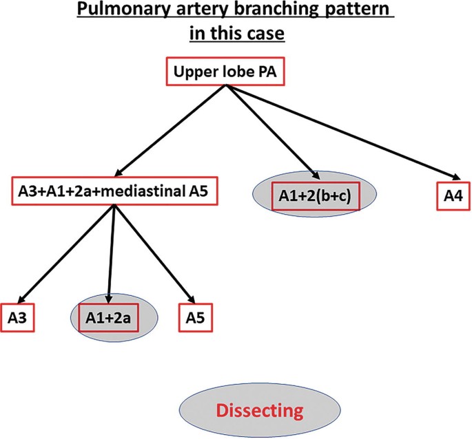 Left S1 + 2 Sleeve Segmentectomy | SpringerLink