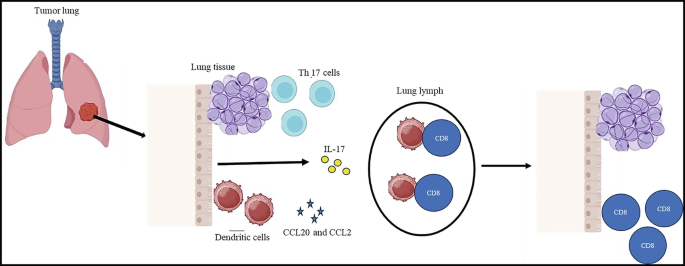 Immunobiology of Lung Cancer | SpringerLink