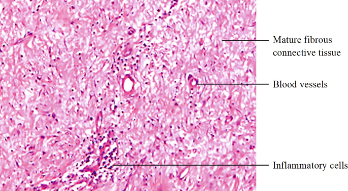 Tissue Repair | SpringerLink