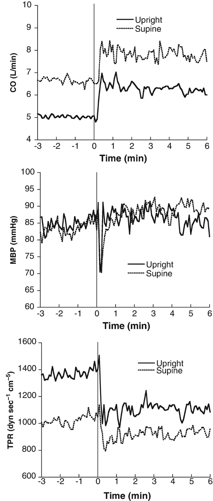 Cardiopulmonary Mechanoreflexes | SpringerLink