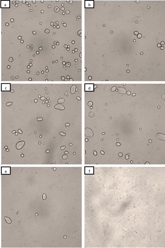 Andean Grain and Tuber Starch: Characteristics, Modifications, and ...