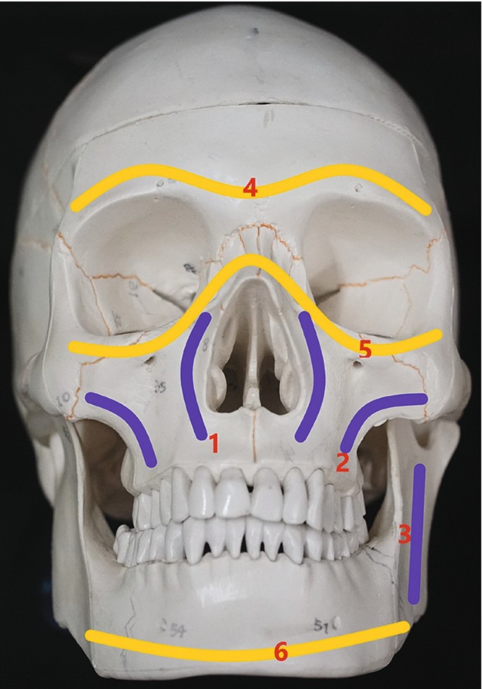 Facial Trauma | SpringerLink
