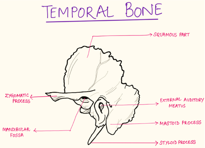 Temporal Bone Fractures | SpringerLink