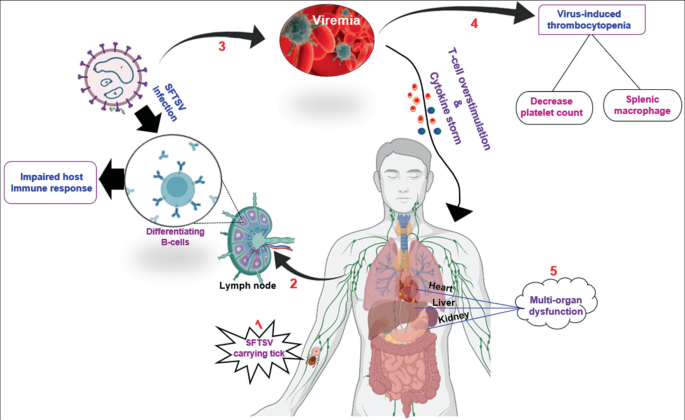 Recent Insight of the Emerging Severe Fever with Thrombocytopenia ...