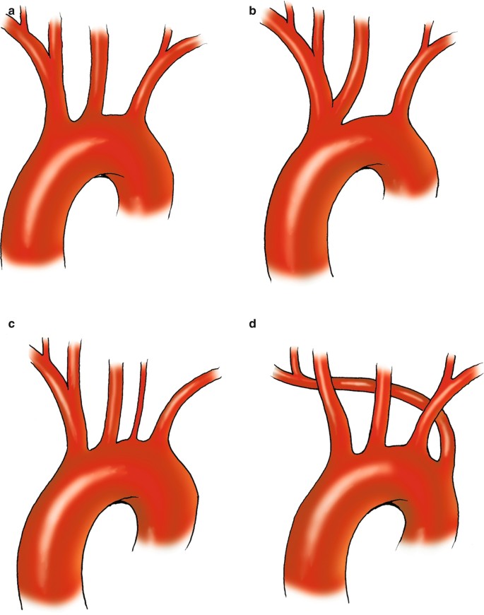 Essential Neurovascular Anatomy | SpringerLink
