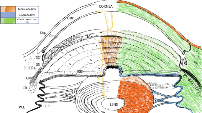Peters Anomaly with Glaucoma | SpringerLink
