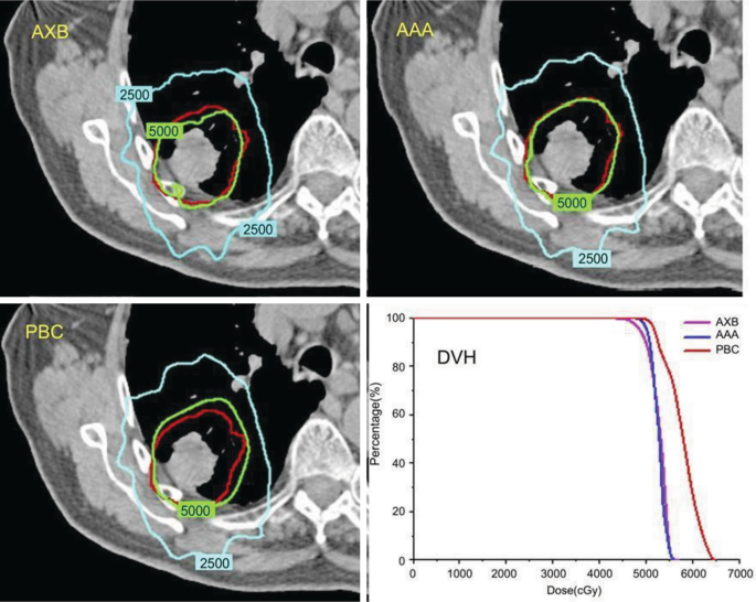Dose Calculation Algorithm | SpringerLink