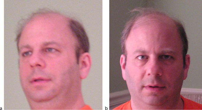 Face Variation | SpringerLink