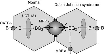 Dubin-Johnson Syndrome | SpringerLink