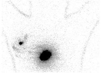 Lymphopoietic System, Diseases of the | SpringerLink