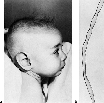 Battered Child Syndrome | SpringerLink