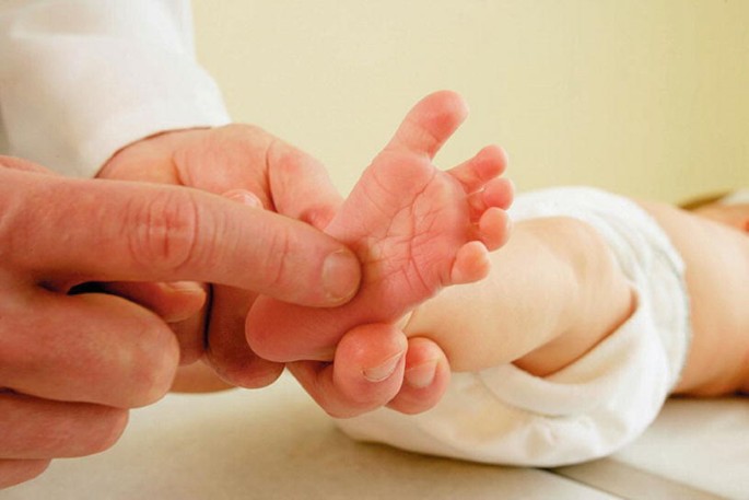 Newborn Reflex | Springer Nature Link