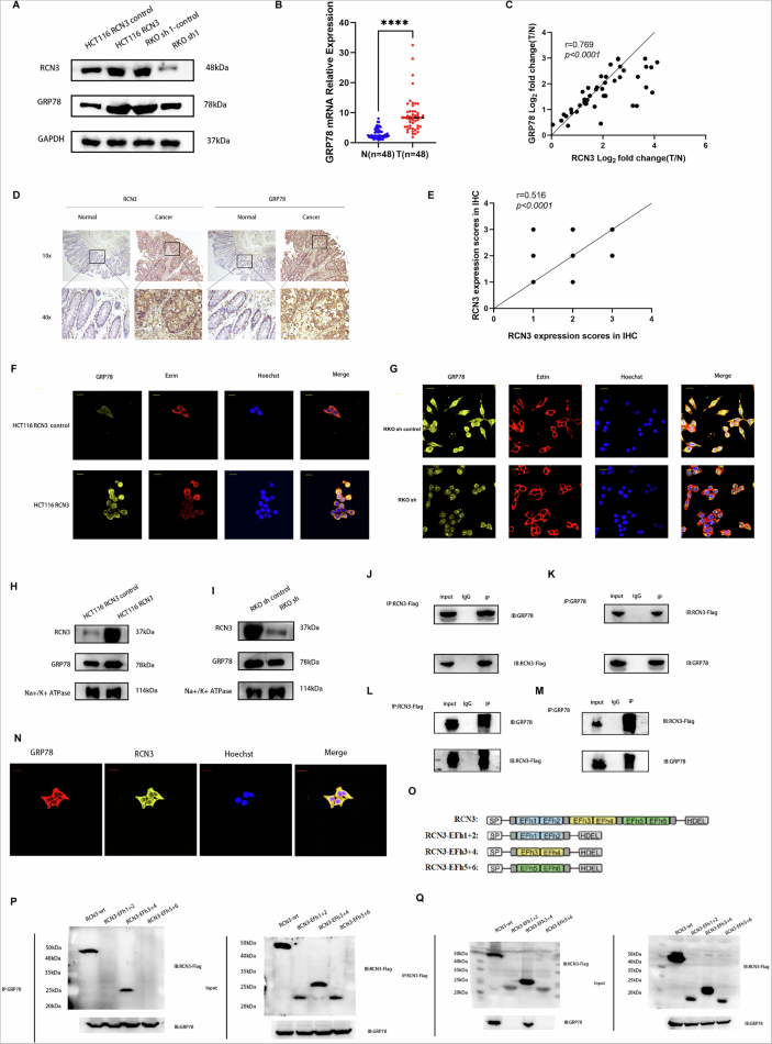 Publisher Correction: RCN3 functions as a tumor promoter in colorectal cancer by modulating the ...