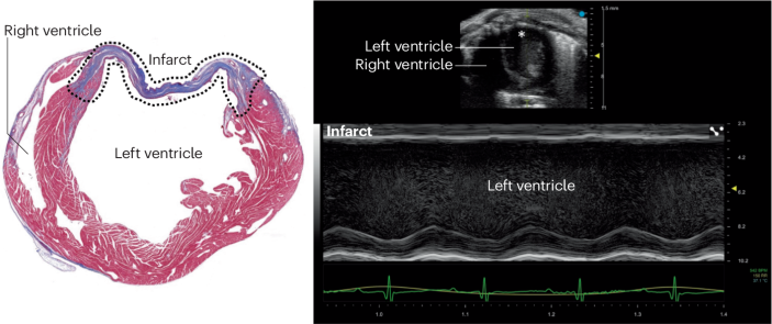 Suture-to-scan: ultrasonography-guided induction of heart injury ...