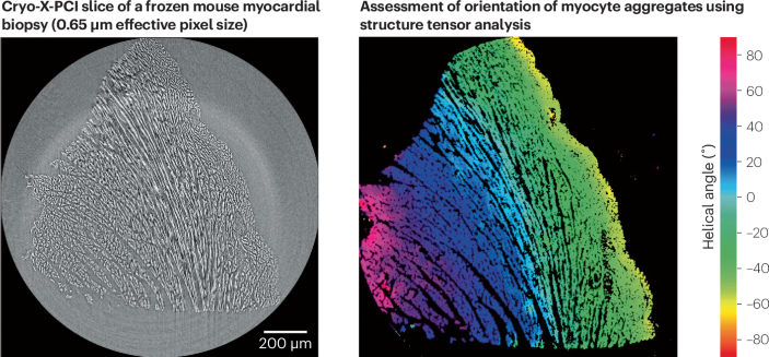 Cryo-X-ray phase contrast imaging for 3D structural and molecular ...